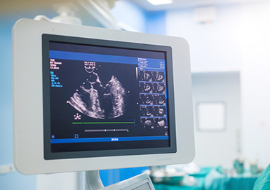 Echocardiogram - Advanced Cardiovascular Center